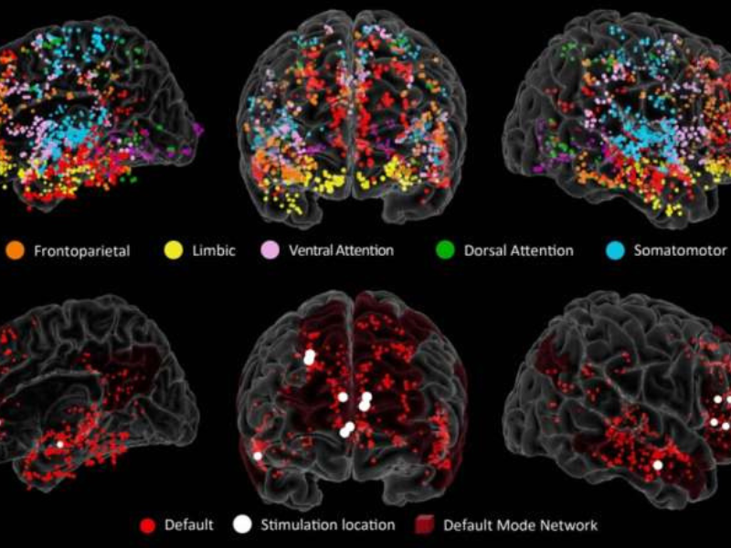 Research Identifies the Brain's Source of Creativity
